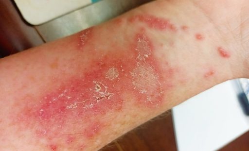 Anna Maria Conti, MD, PhD | Neurology | St. Louis, MO | Mercy